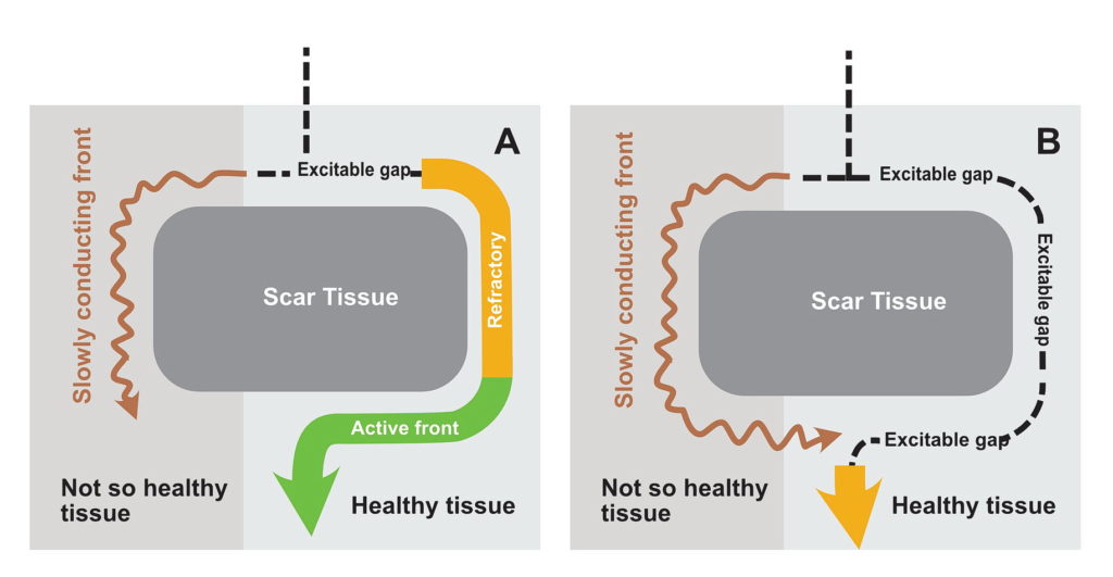 Re-entry | EP Made Easy!