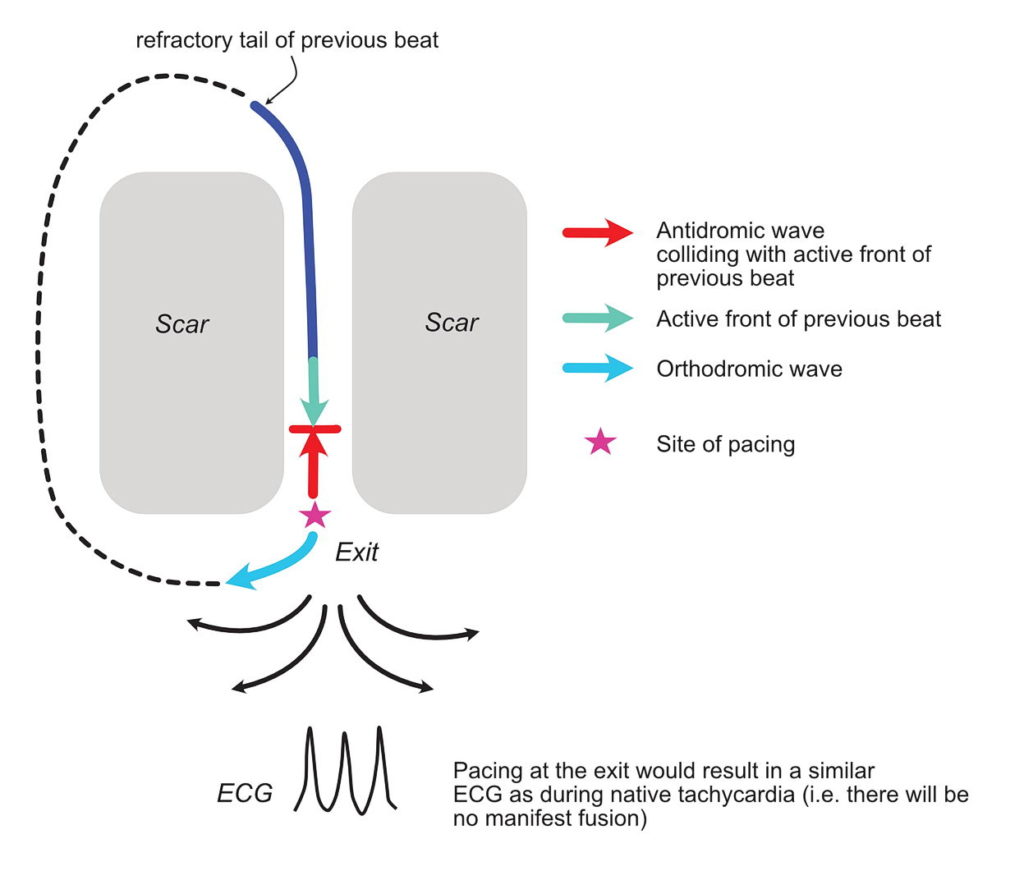 Entrainment - 3 | EP Made Easy!